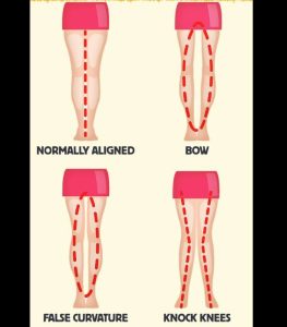 F. The separation between a woman's legs means that she is… See more ...